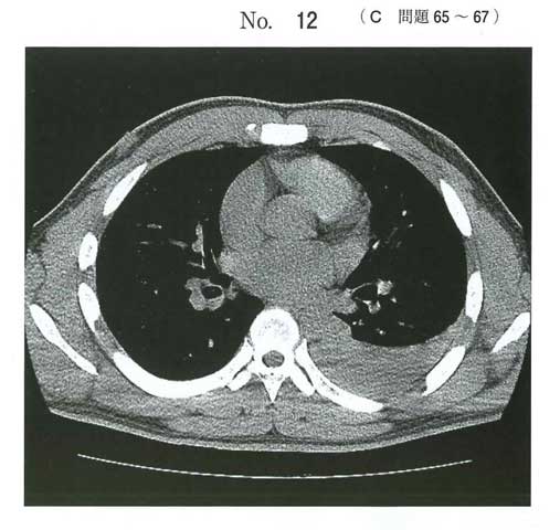 119C-66 : C問題 | MEC国試速報掲示板