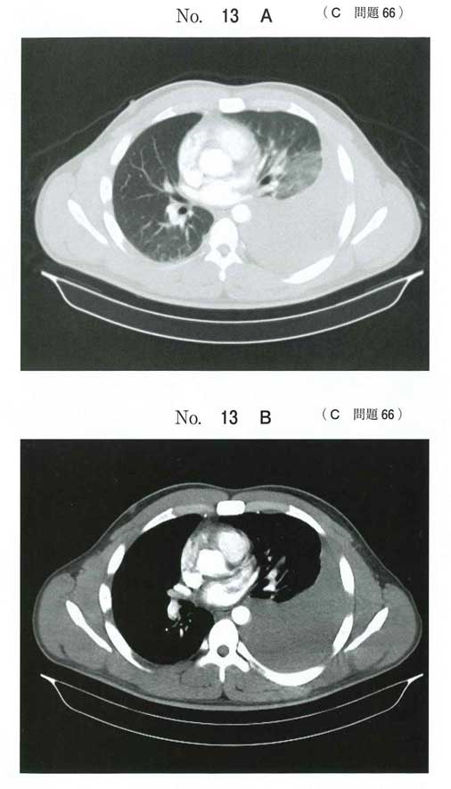 119C-66 : C問題 | MEC国試速報掲示板